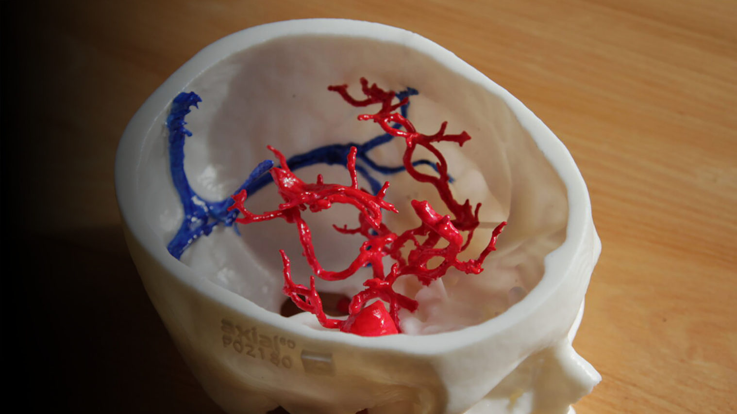 Axial3D: Making More Precise Medical Treatment Possible | Fast Radius